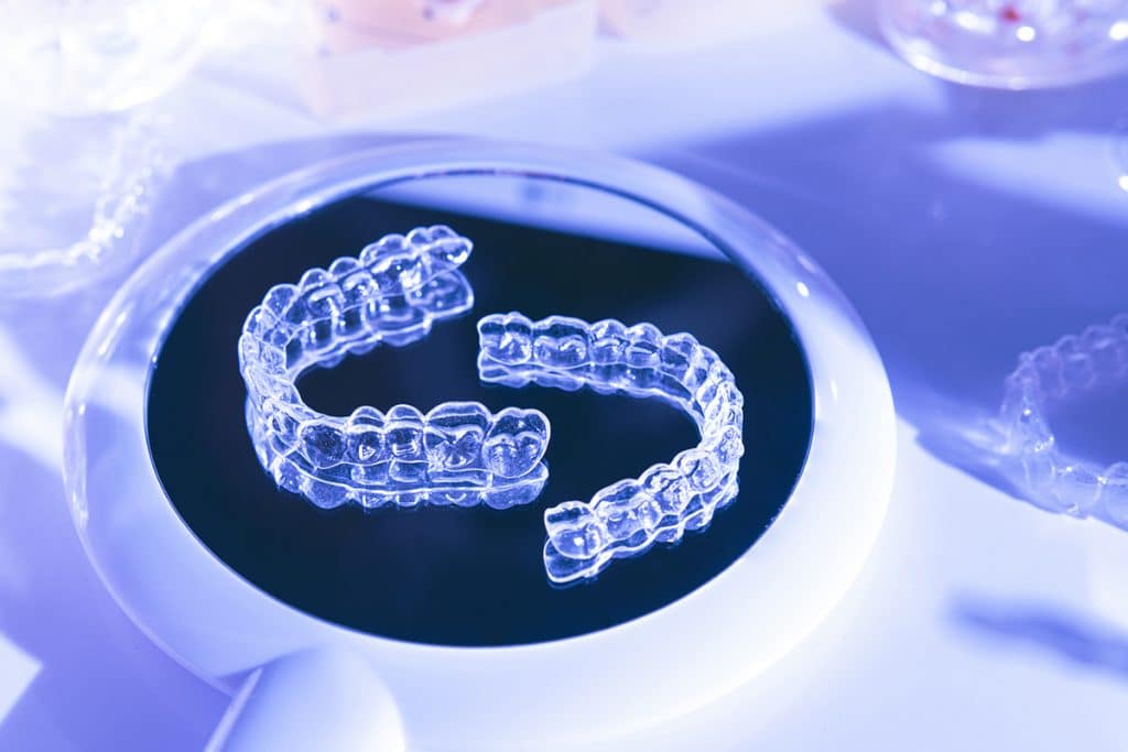 Clear Aligners Consultation Guide - Kragor Orthodontics
